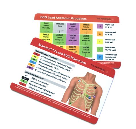 Australian And New Zealand Paramedic Standard 12 Lead Ecg Placement Ecg