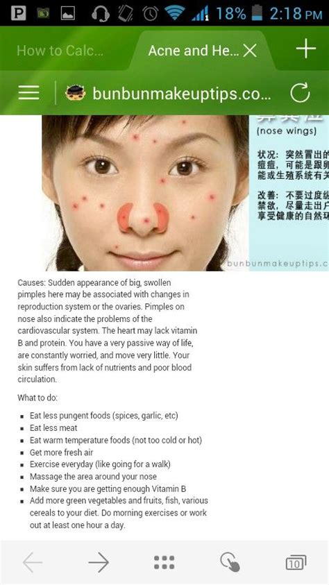 Nose Pimples How To Get Rid Of Pimples Pimples Medical Words