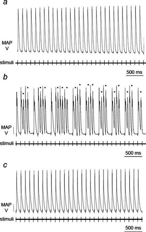 Monophasic Action Potential Map Recordings From Extrinsically Paced Download Scientific