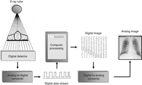 Digital Radiography Market Segmentation Analysis By Recent Trends Development By Regions To 2030