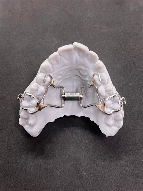 843 Laser Sintered Banded And Bonded Rpe Hyrax Super Screw No Seperators Required Eodo