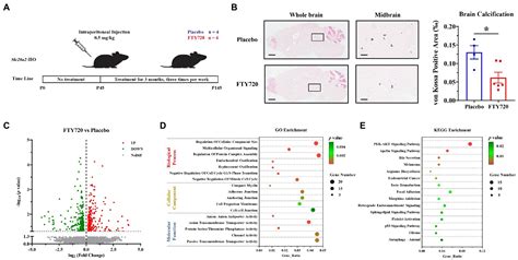 T Cell Infiltration In The Central Nervous System And Their Association With Brain Calcification