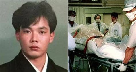 Hisashi Ouchi Der Verstrahlte Mann Wurde 83 Tage Lang Am Leben Gehalten