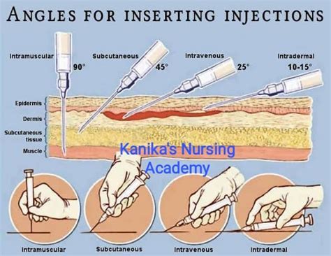 Angles For Injection Administration Kanikas Nursing Academy Facebook