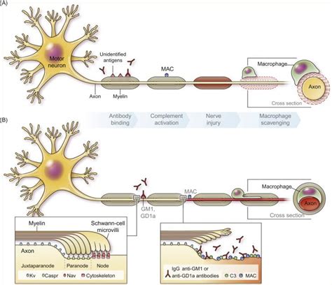 Acute Polyneuropathies Clinical Tree