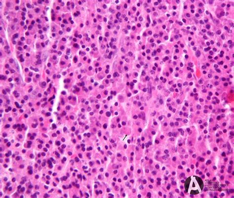 Plasma Cells Histology