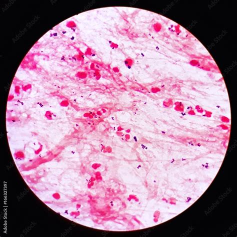 Examining Specimen Under Microscope At Timothy Simpson Blog