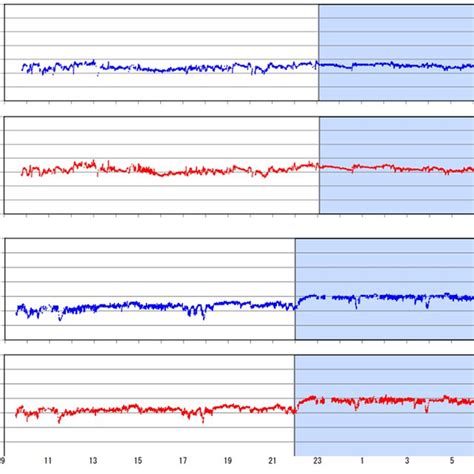 Representative The Trend Of Qt Interval Along With The 24‐hour Study In Download Scientific