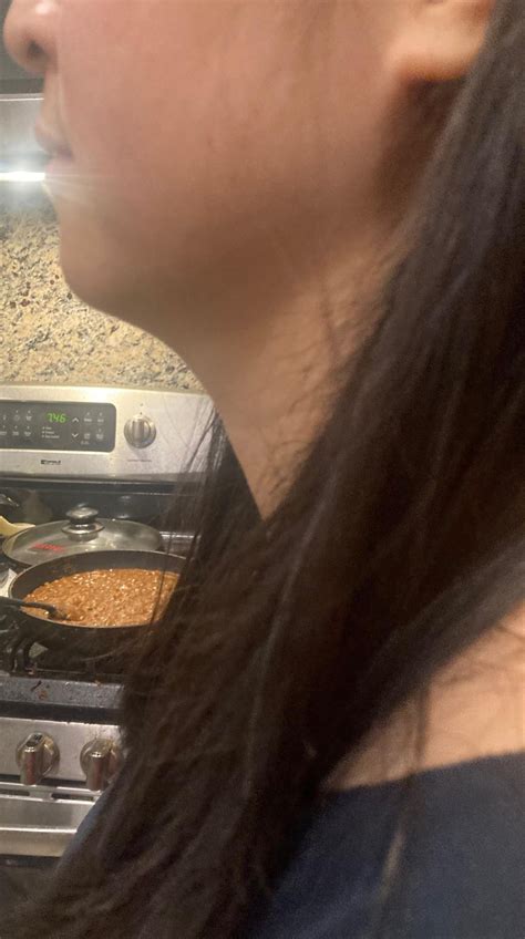 What Is A Good Surgery For A More Defined Jaw R Plasticsurgery