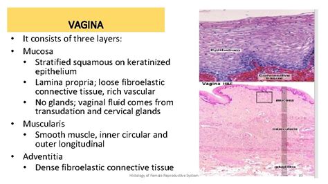 Histology Of Female Reproductive Systemic Histology Ii Atiba