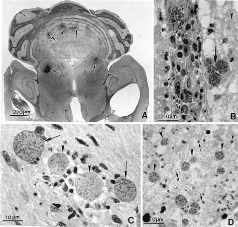 Encephalitis In The Brain Of A Mouse 87 Days After Being Fed Oocysts Of