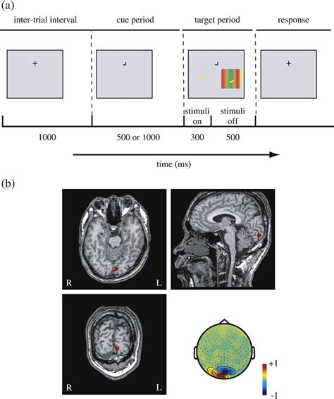 figure 1 from elsevier editorial system tm for brain research
