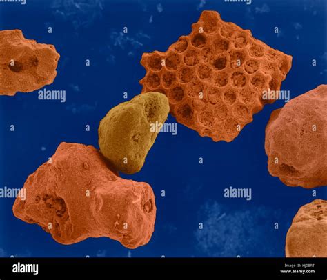 Coloured Scanning Electron Micrograph Sem Of Coral Sand Kailua Hawaii Beach Sand Contains