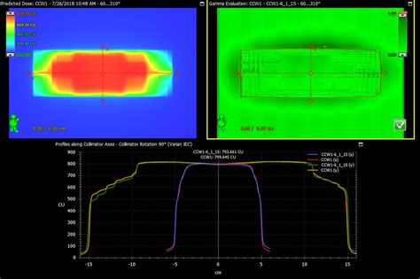 Image Of A Delivered Epid Treatment Verification Plan Top Left The Download Scientific