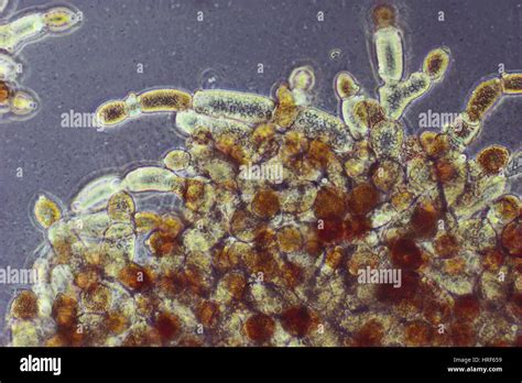 Chytridiomycota Plant Life Chytrids