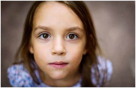 Dravet Syndrome Life Expectancy Icd 10 Code Symptoms Treatment