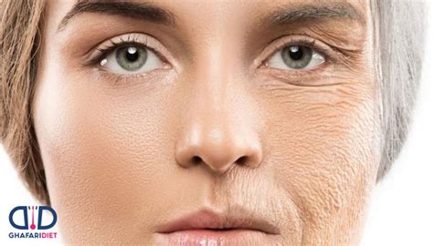 چروک صورت، ۱۵ روش درمان و پیشگیری