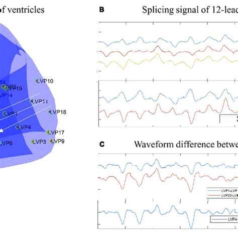 Example Of Connections Between Wave Morphology And Physical Positions