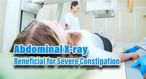 Constipation X Ray Procedure Results And Treatment Mega Doctor News