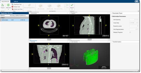 deformable registration using medical registration estimator app