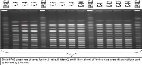 Pfge Of Not 1 Digested Genomic Dna Of V Cholera O1 Inaba And Ogawa