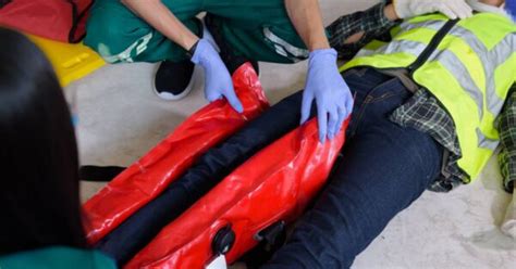 Innovative Splinting Techniques And Devices For First Responders