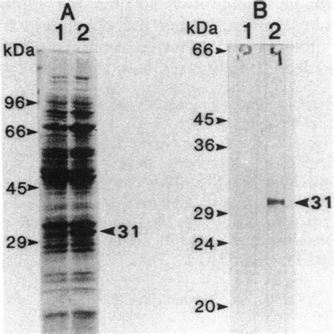 Expression Of The 31 Kda Protein In E Coli An Nco I Ecori