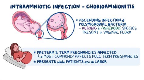 Intraamniotic Infection Clinical Sciences Osmosis Video Library