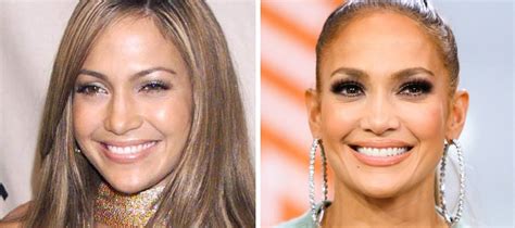 راز جوانی جنیفر لوپز از زبان کارشناسان