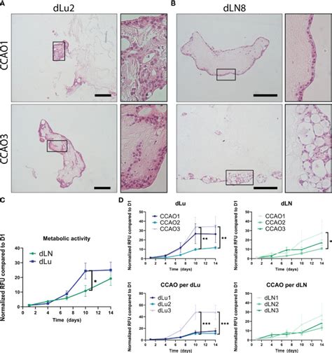 Modelling Metastatic Colonization Of Cholangiocarcinoma Organoids In