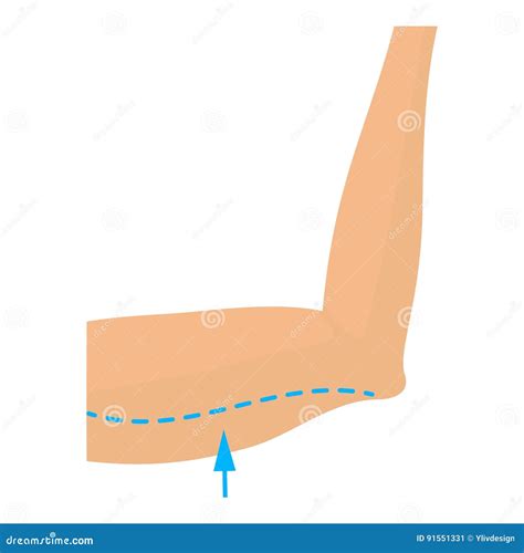 Biceps Plastic Correction Icon Cartoon Style Stock Vector Illustration Of Person Medicine