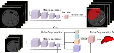 Framework Of The Liver Segmentation Download Scientific Diagram
