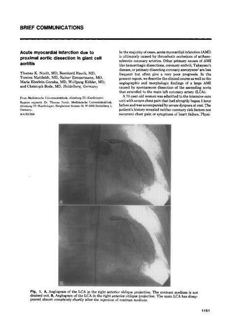 Pdf Acute Myocardial Infarction Due To Proximal Aortic Dissection In Giant Cell Aortitis