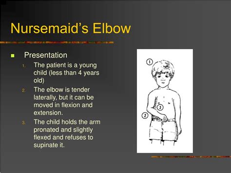 Ppt Dislocation And Fracture Reductions Powerpoint Presentation Free