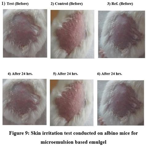 Formulation Development And Evaluation Of Microemulsion Based Lornoxicam Gel Biosciences