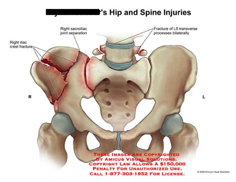 Medical Exhibits Demonstrative Aids Illustrations And Models