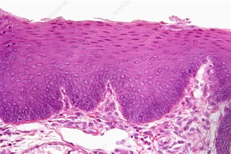What Are Pseudostratified Squamous Epithelium At Oliver Gonzalez Blog