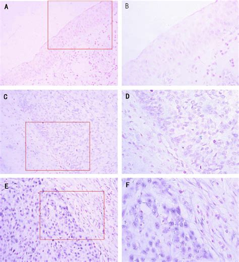 Representative In Situ Hybridisation For Mir 93 Expression In Primary
