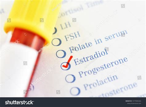Blood Sample Tube Laboratory Requisition Form Stock Photo 1577836342 Shutterstock