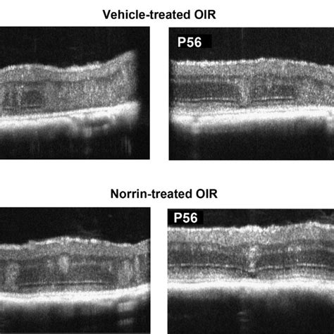 Sd Oct Horizontal B Scan Data Of The Retinal Laminar Structure At Ages