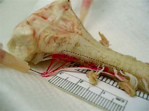 Figure 3 From Trigeminal Nucleus Caudalis Anatomy Guidance For Radiofrequency Dorsal Root Entry