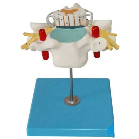 Buy Pvc Human Anatomy Magnifies Cervical Spinal Cord And Spinal Nerve