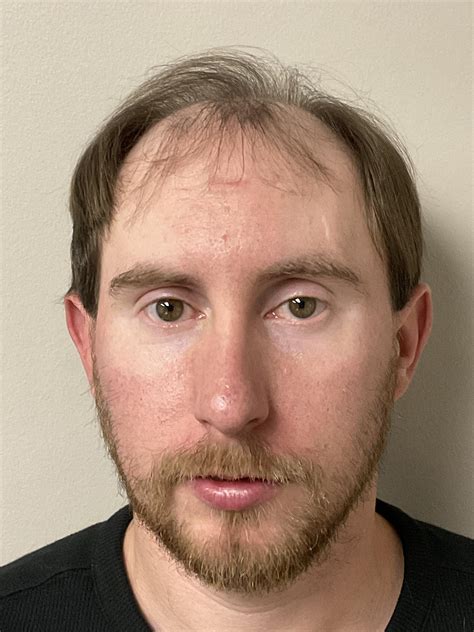 Philip Collins Violent Or Sex Offender In Monticello In 47960