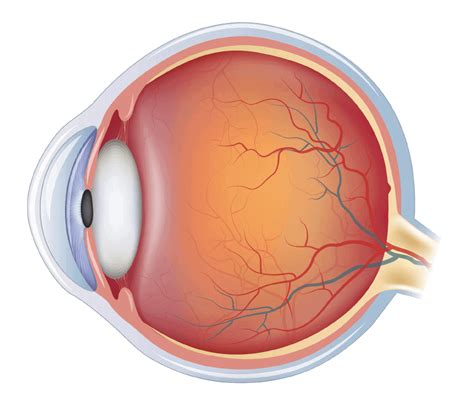 Lattice Degeneration Understanding The Risks To Your Retinal Health Specialty Vision