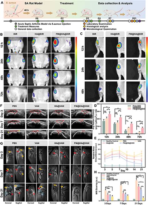 四川大学熊燕副教授、杨佼佼副研究员、李箭教授 Small：双靶向的细胞膜囊泡仿生纳米系统用于化脓性关节炎治疗 中国聚合物网科教新闻