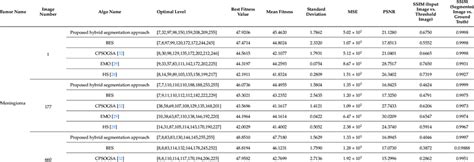 Evaluation Metrics Of The Proposed Hybrid Segmentation Approach