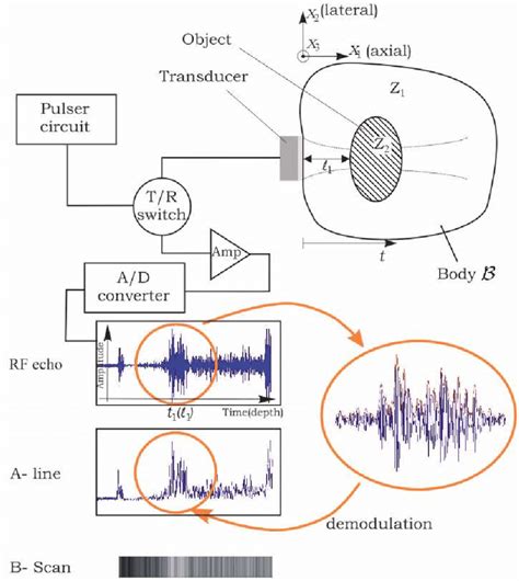 1 Elements Of A Simplified Ultrasound Pulse Echo Instrument The Download Scientific Diagram