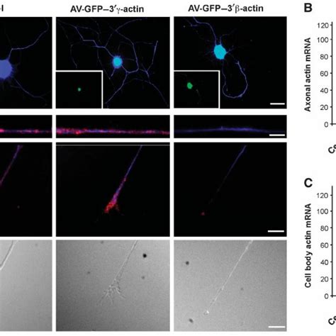Drg Neurons Expressing Gfp With 3′utr Of β Actin Show Decreased Axonal Download Scientific