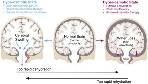 Shifts In Plasma Osmolality Over Tens Of Minutes Can Lead To Brain Download Scientific Diagram