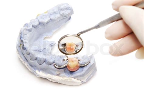 Tandprotese På Gips Model Gips Med Dental Værktøj Stock Foto Colourbox